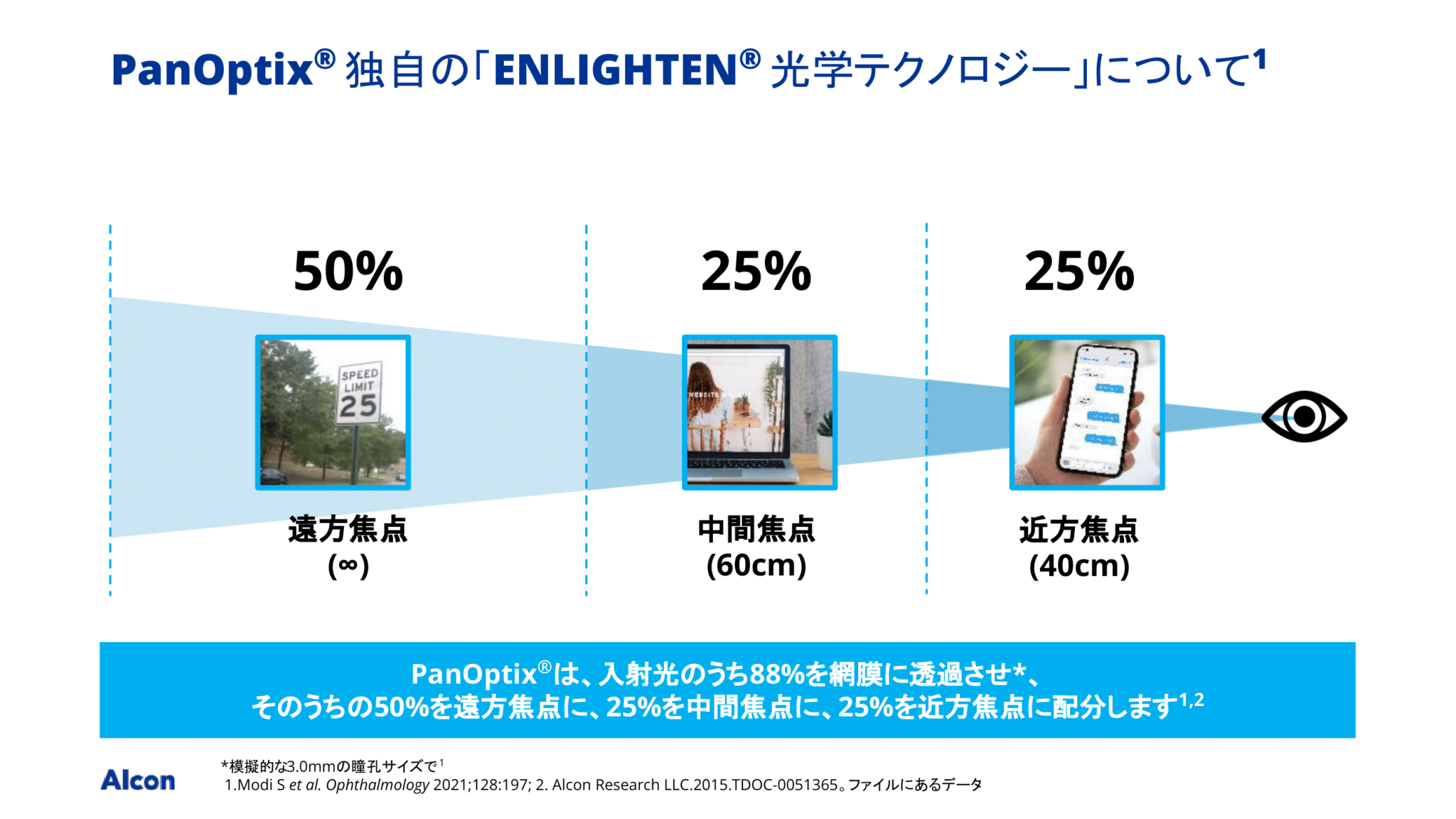 パンオプティクス（PanOptix）・国内初の3焦点眼内レンズ-特徴、見え方、費用について｜ふくおか眼科クリニック 中野