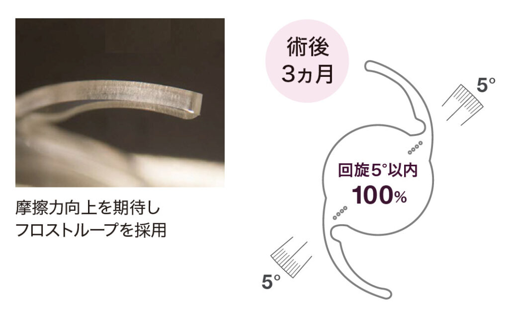 テクニスオデッセイ（TECNIS Odyssey） - 連続焦点型の多焦点眼内レンズ｜ふくおか眼科クリニック 中野